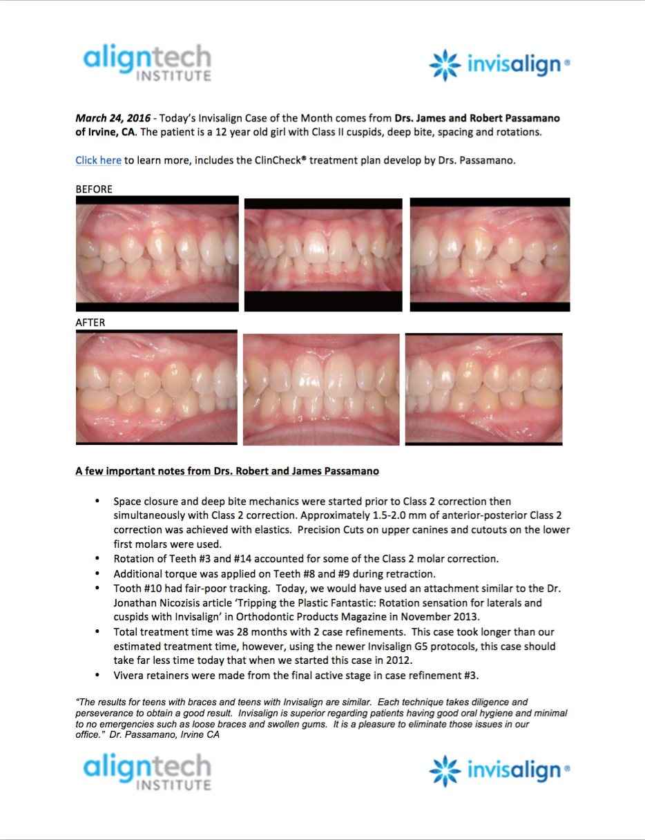 2016 Invisalign Case of the Month Award - Passamano Orthodontics
